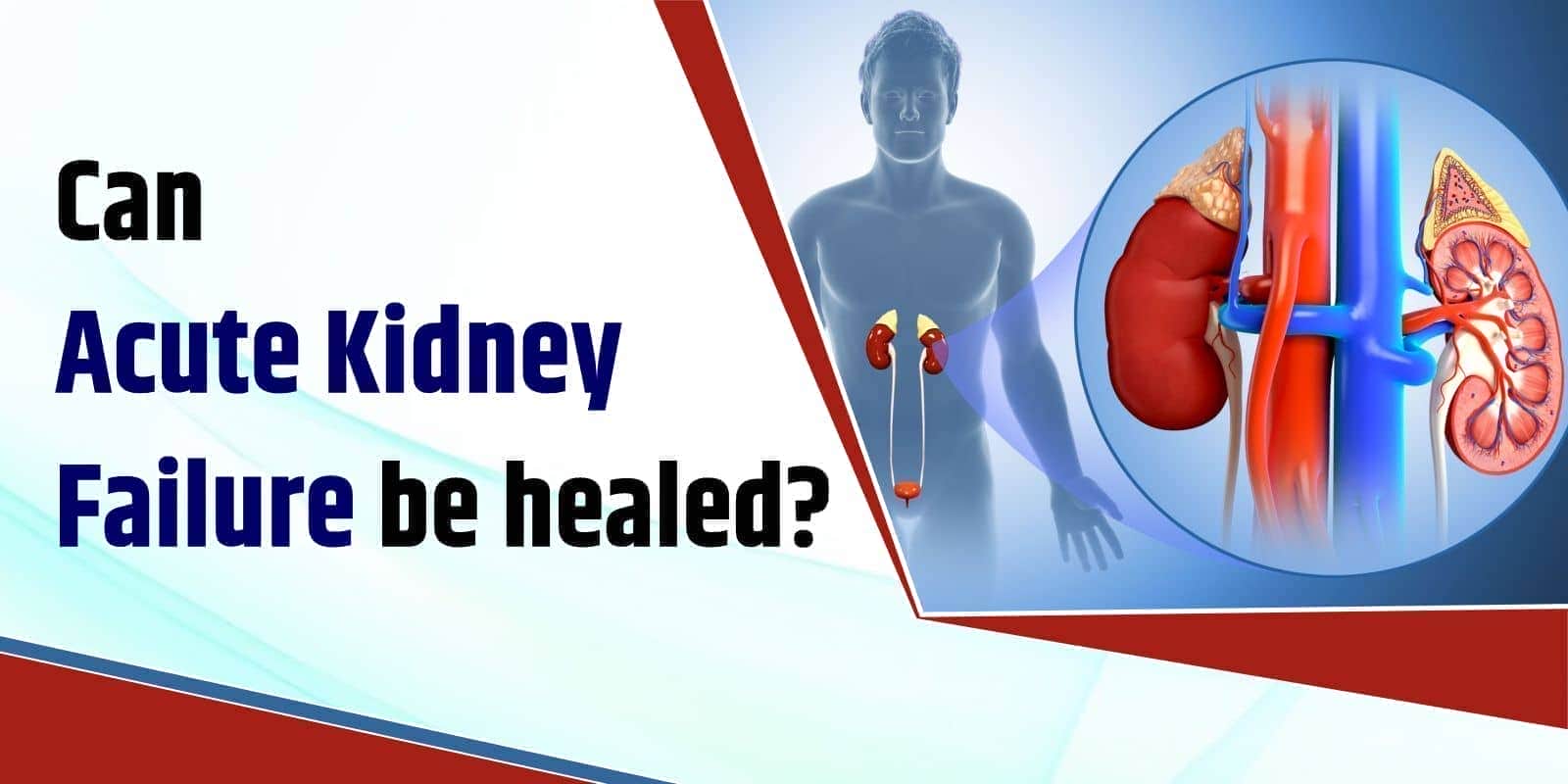 Diagnosis of Acute Renal Failure: Tests & Early Signs