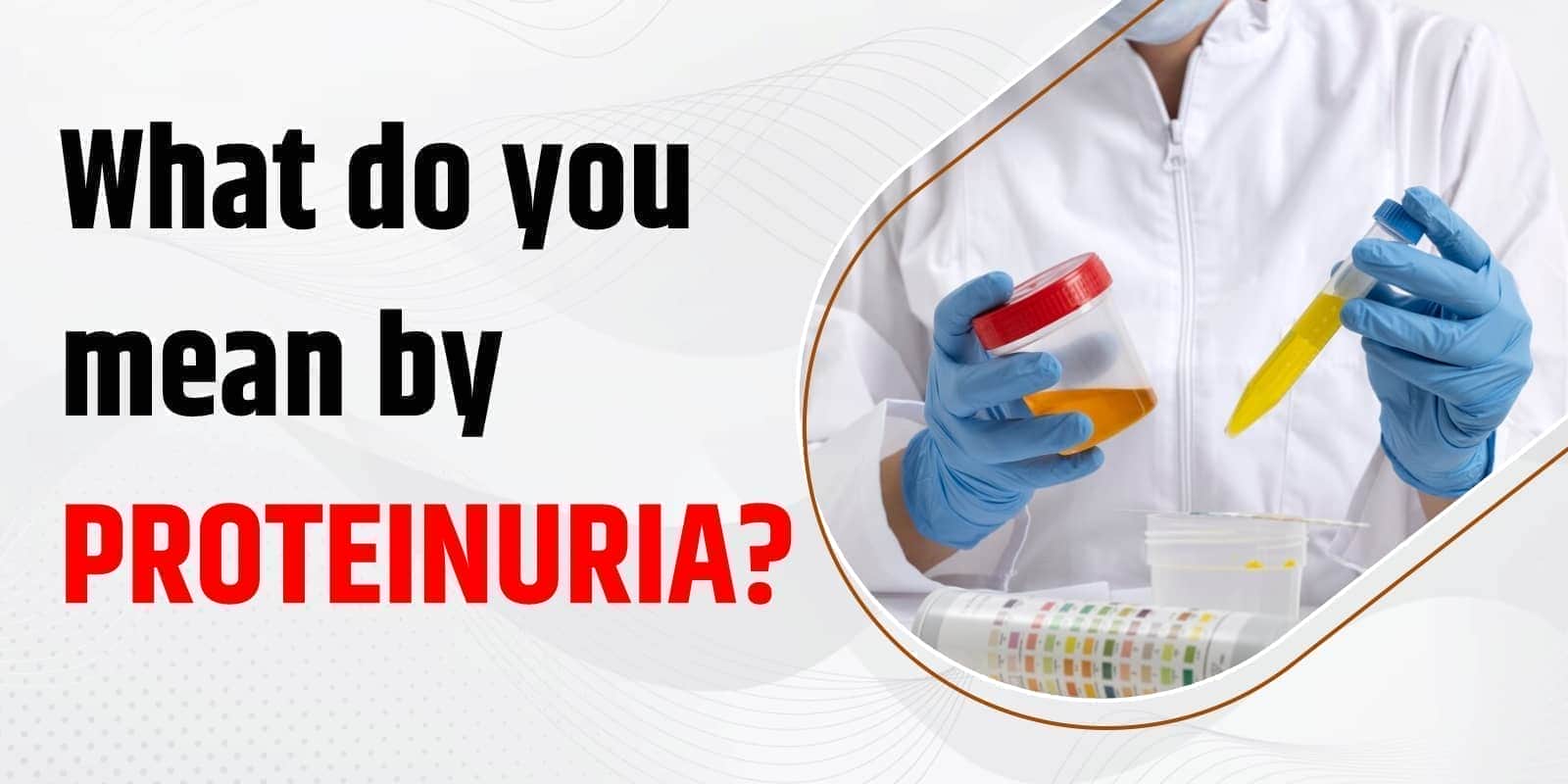 Natural Cure for Proteinuria - Ayurvedic Remedies