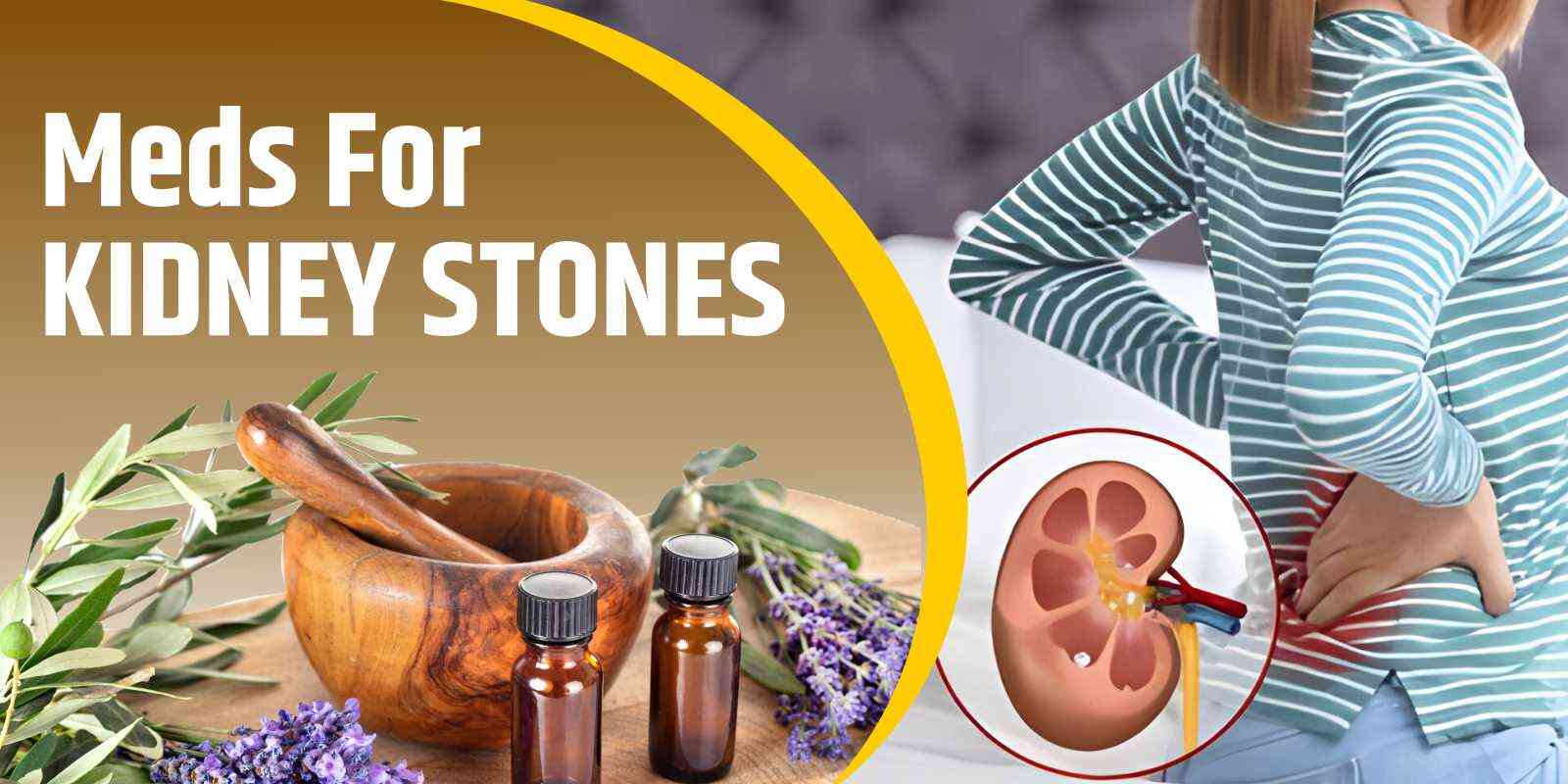 Meds for Kidney Stones | Effective Treatments