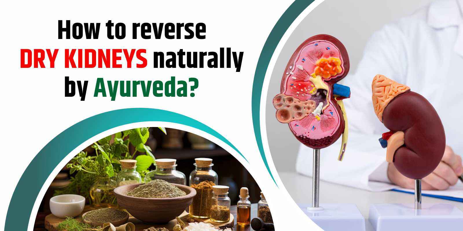 Reverse Dry Kidneys Naturally with Ayurveda: Effective Tips