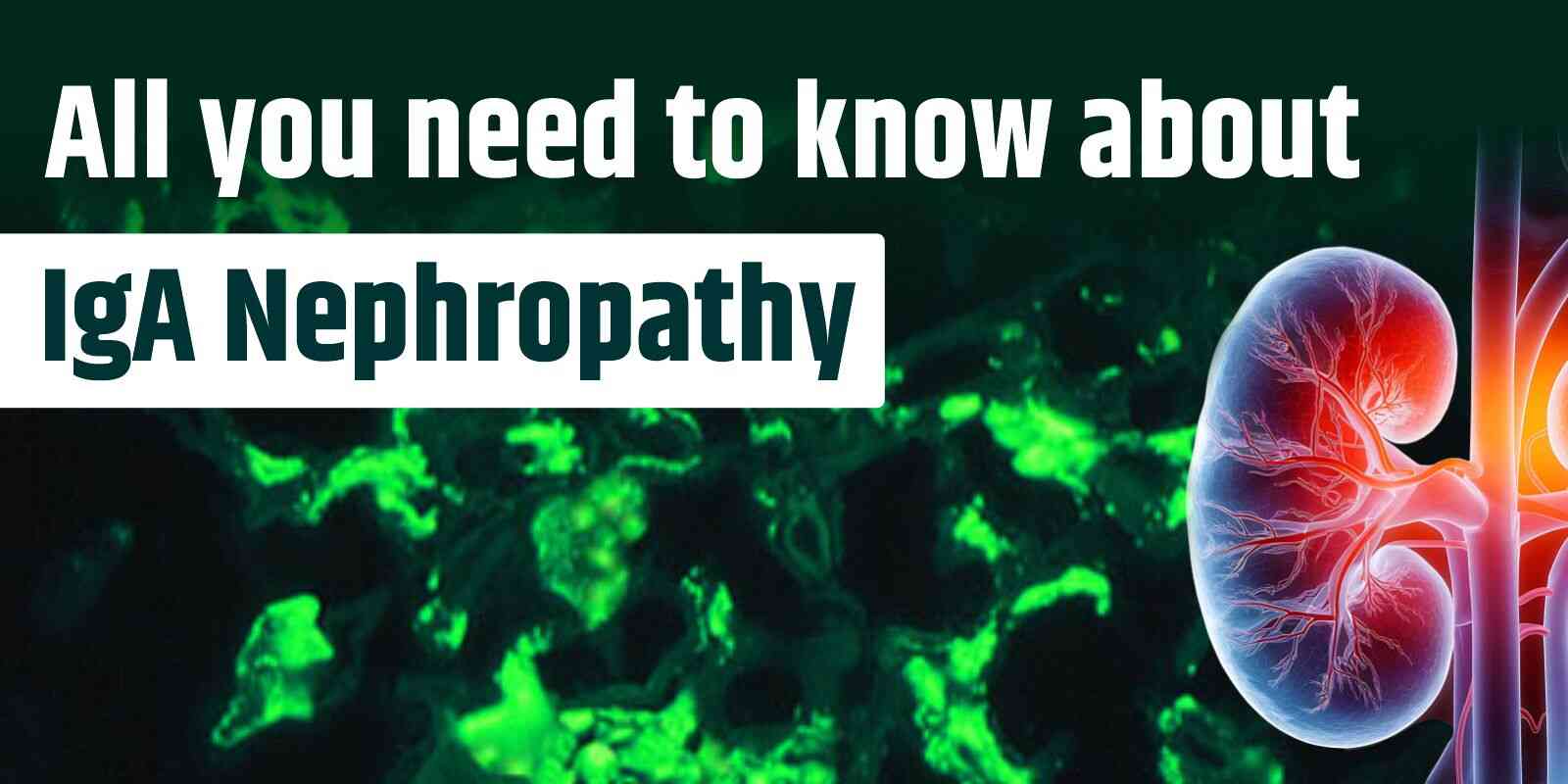 All You Need to Know About IgA Nephropathy: Causes & Care