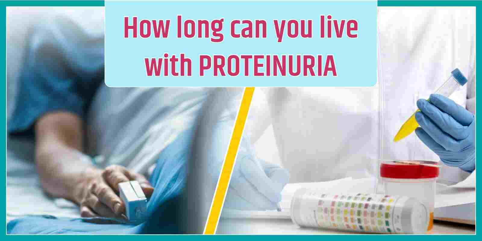 How Long Can You Live with Proteinuria? Key Facts to Know