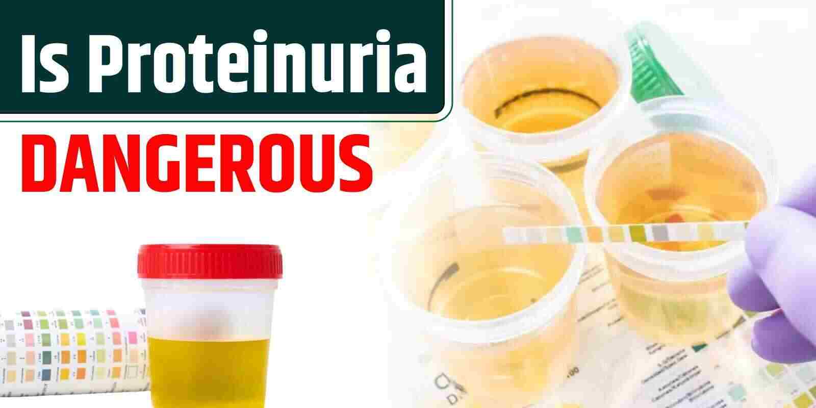 Ayurvedic Treatment for Albumin in Urine: Natural Remedies