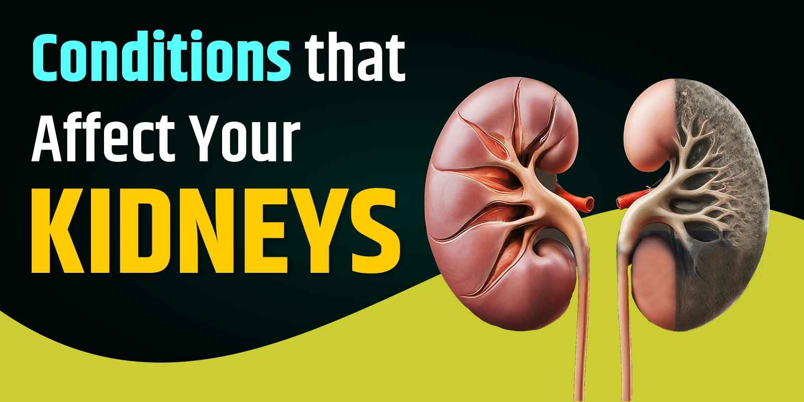 Conditions That Affect Your Kidneys: Key Health Risks