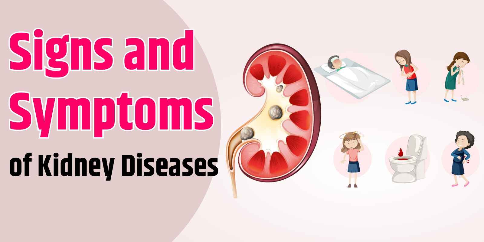 Signs and Symptoms of Kidney Diseases You Should Know