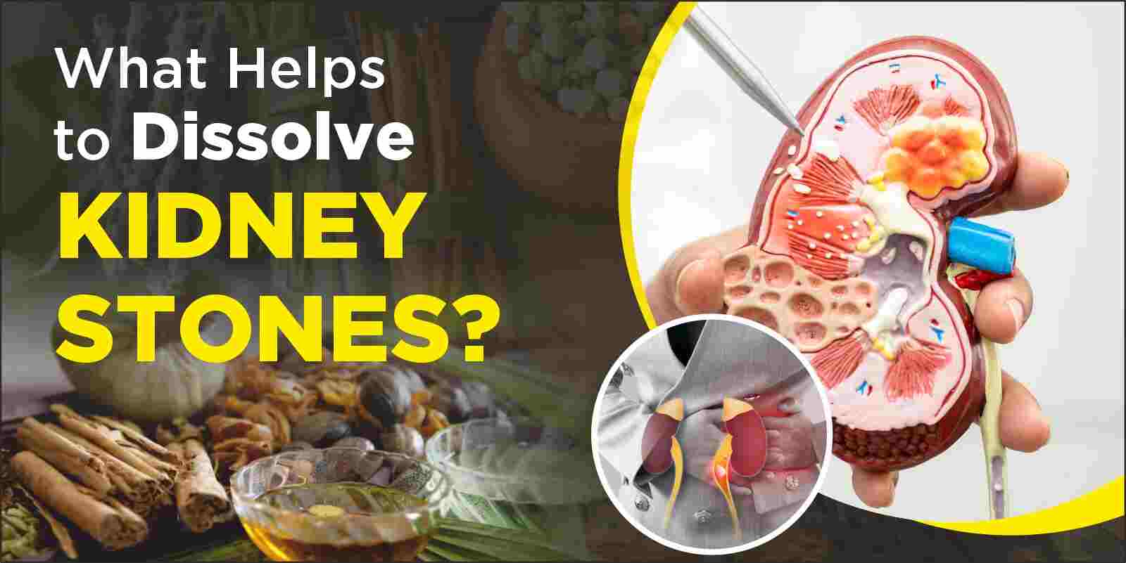 What Helps to Dissolve Kidney Stones? Natural Solutions